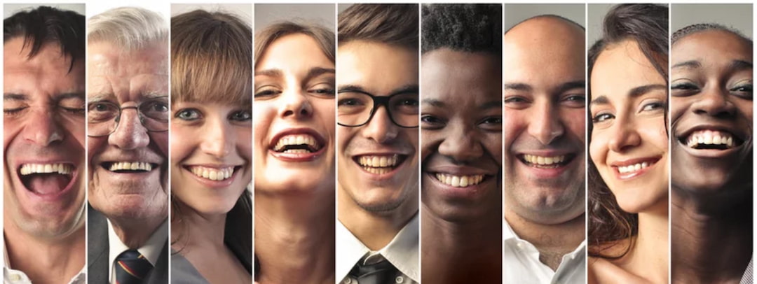 Smile Makeover Before and After - OC Dental Center