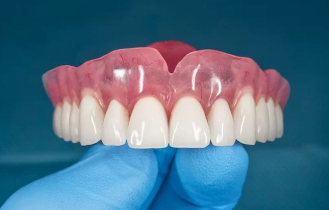 Not Enough Bone for Dentures - OC Dental Center