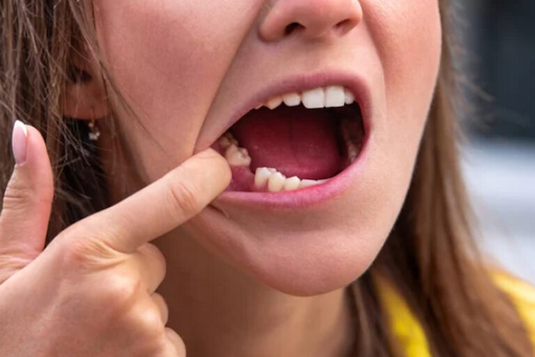 Average Number Of Teeth By Age - OC Dental Center