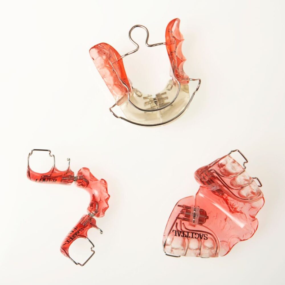 How Long Do You Have to Wear a Retainer? - OC Dental Center