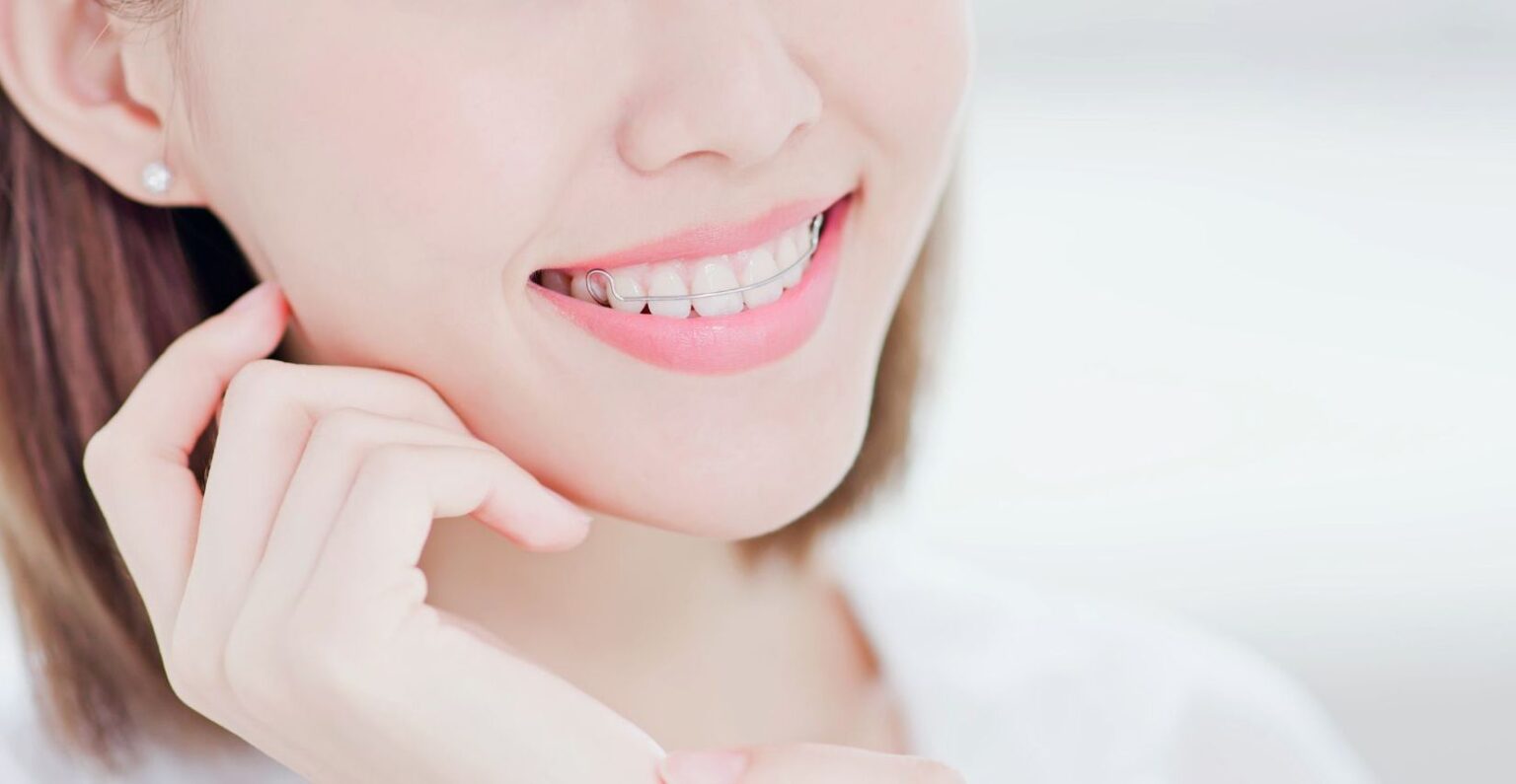 Do Retainers Close Gaps? - OC Dental Center