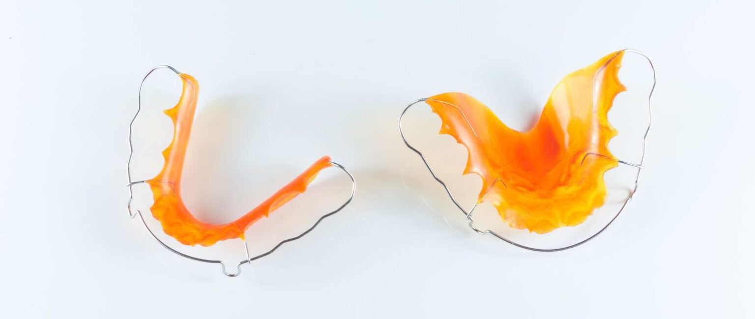 How Much Is a Replacement Retainer? - OC Dental Center